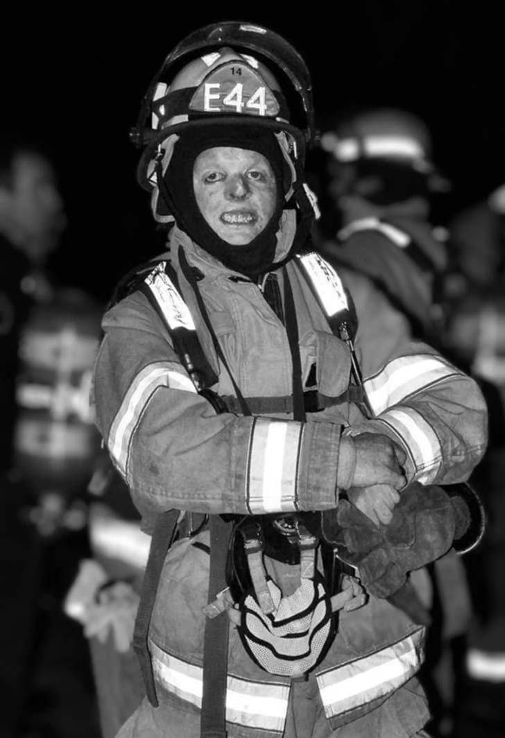 This burn survivor became a firefighter to help save others. Now he ...