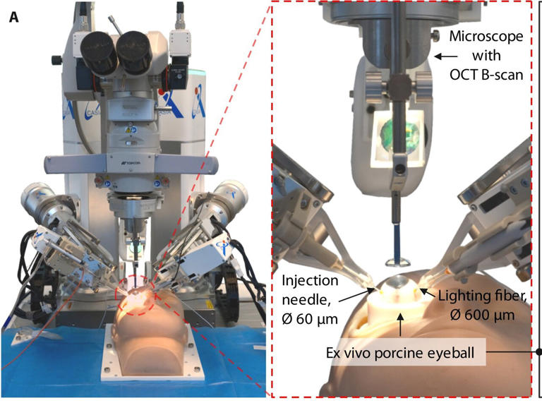 A new robotic system could perform delicate eye surgery