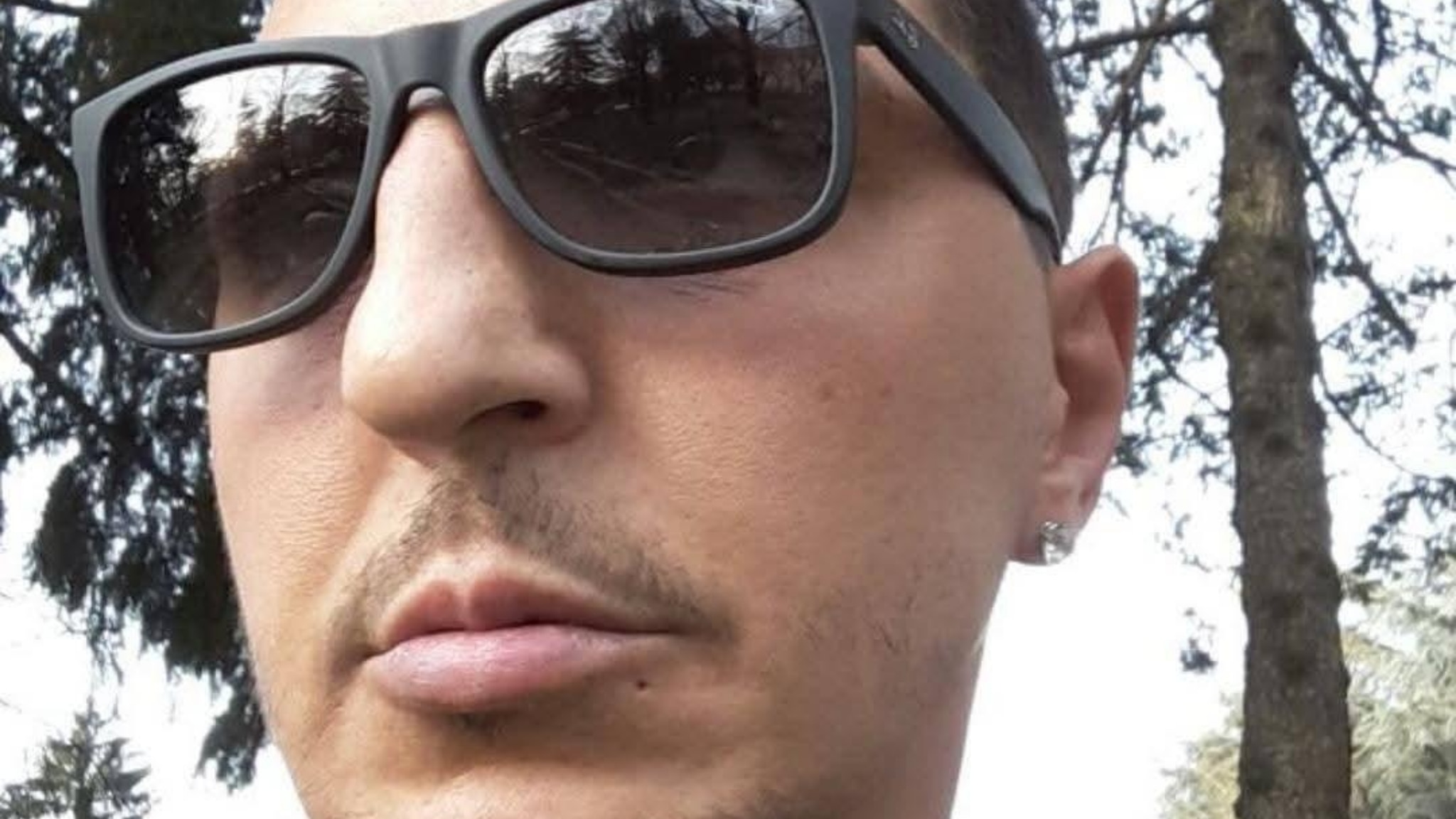 Vercelli, è morto l'uomo che a Capodanno aveva perso la mano per un petardo