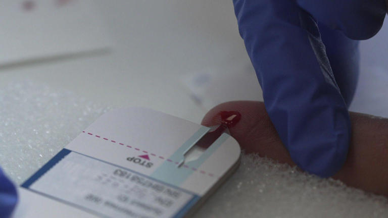 Alzheimer's finger-prick test could help diagnosis
