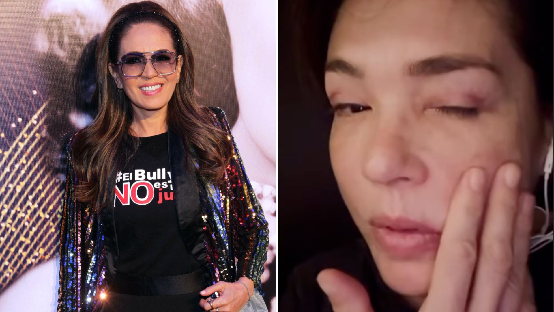 Yolanda Andrade impacta al mostrar su deterioro físico tras ser ...