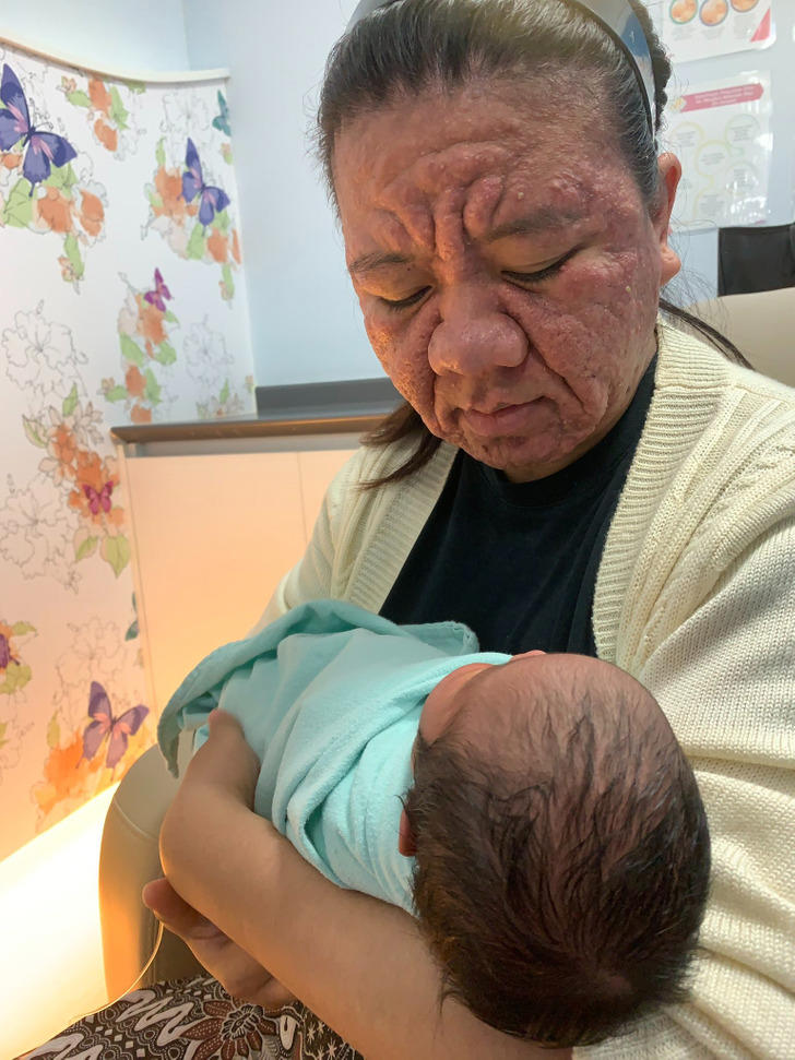 28-year-old woman reveals shocking face changes during pregnancy