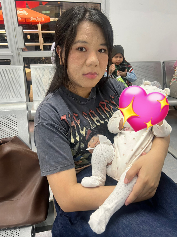 28-year-old woman reveals shocking face changes during pregnancy