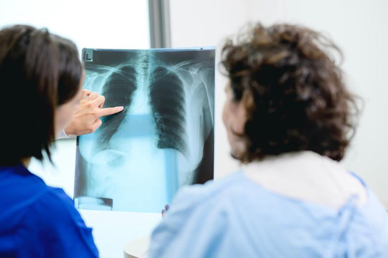 Groundbreaking €4.9m initiative helps identify people with early lung ...