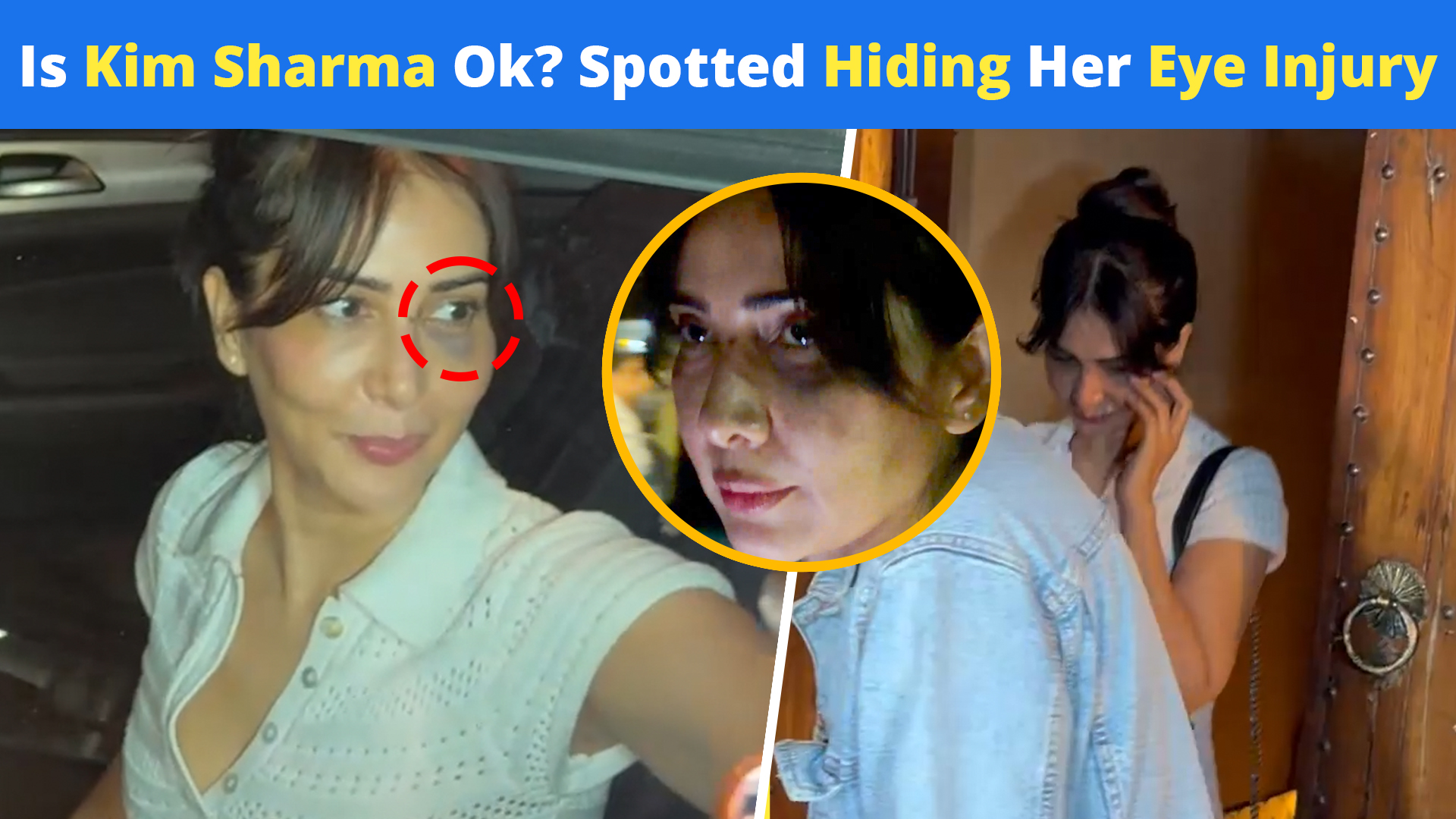Kim Sharma spotted covering her eye injury, sparks concern after ...