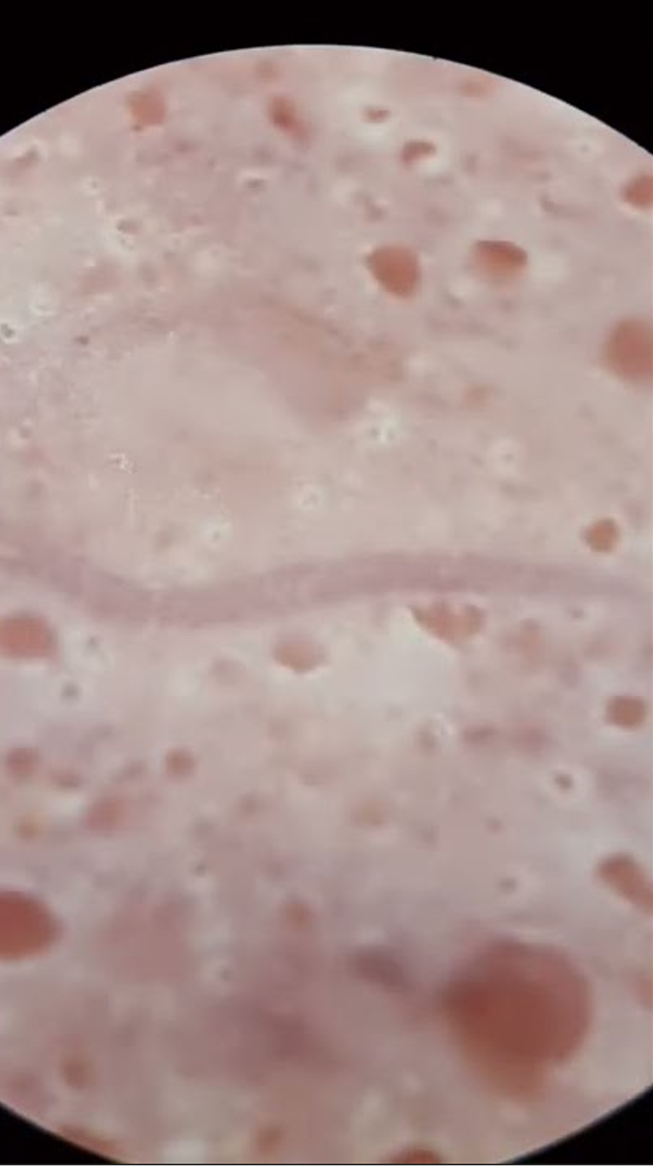 I found microplastic in this hotdog under the microscope!