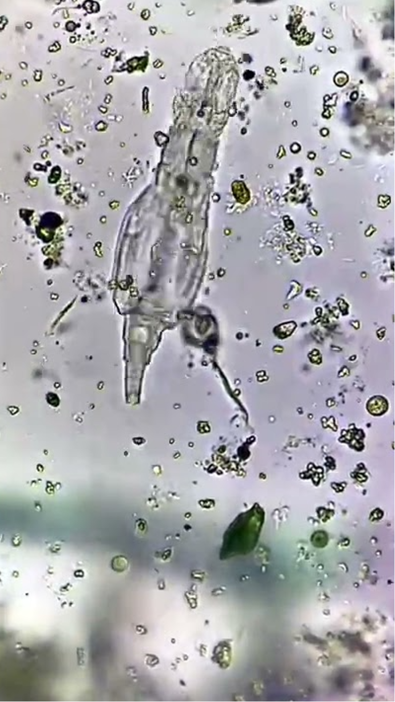 Washing machine filter under the microscope!