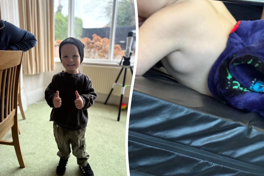 Toddler diagnosed with rare cancer after mum spots chest turning blue ...