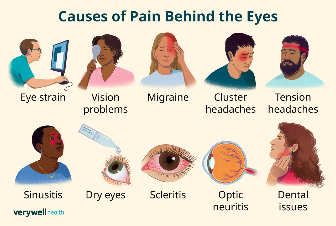 Why is there pain behind my eye? 10 common causes