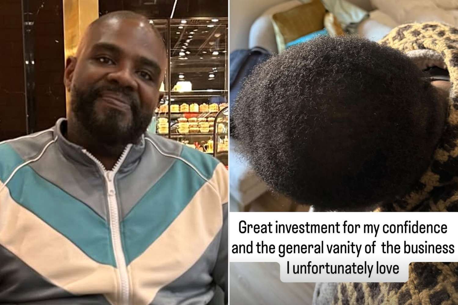 Comedian Ron Funches reveals he was in the 'shedding phase' of hair ...