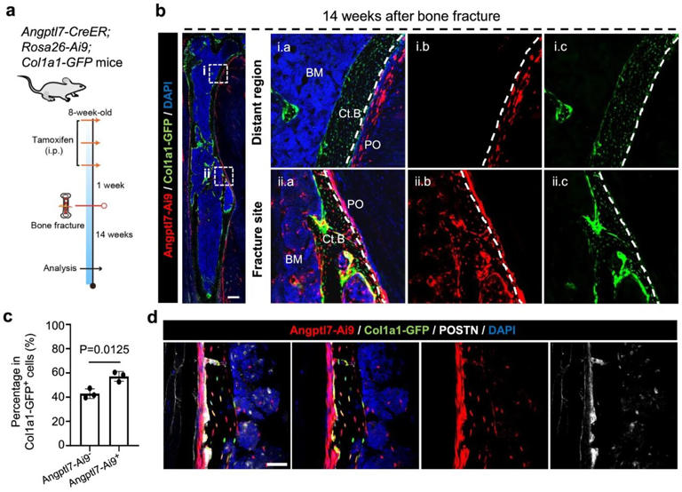 Stem cell subpopulation found to be essential for bone fracture repair