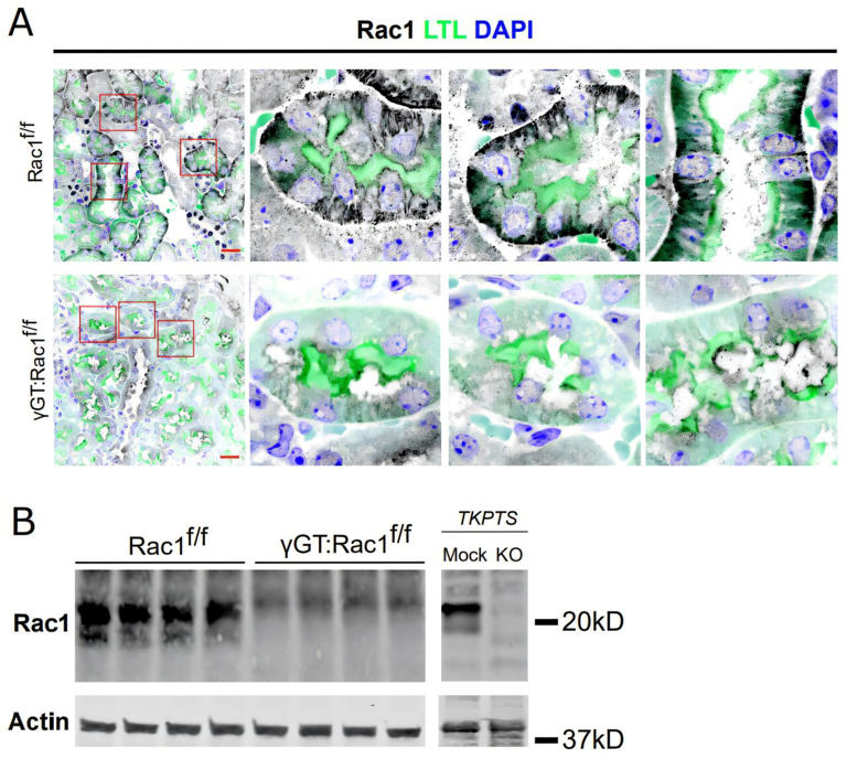 Protein Rac1 plays dual roles in repairing damaged kidney, study finds