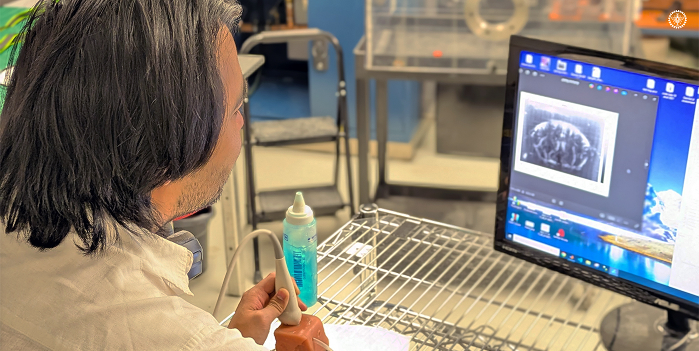 La circulation sanguine du cerveau est cartographiée de manière sans ...