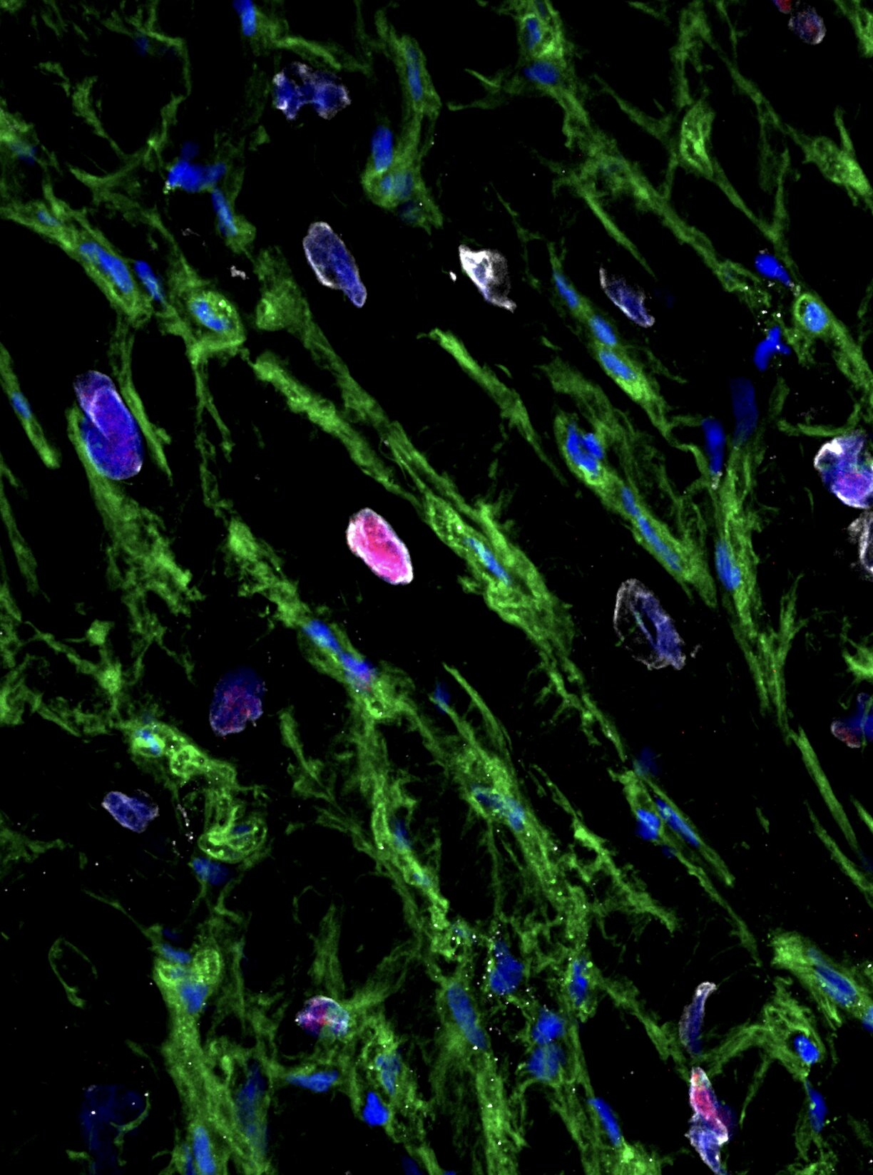 Human heart regrows muscle cells after heart attack, researchers discover