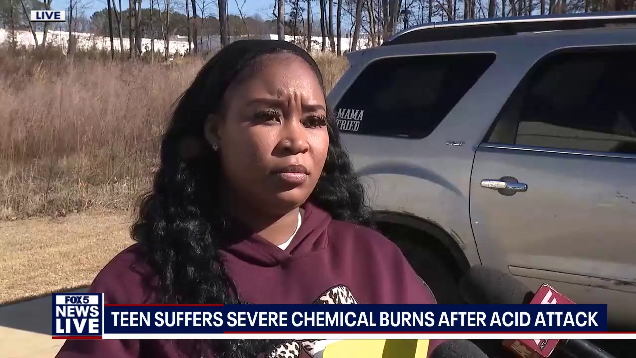 Middle school fight leaves teen with severe burns