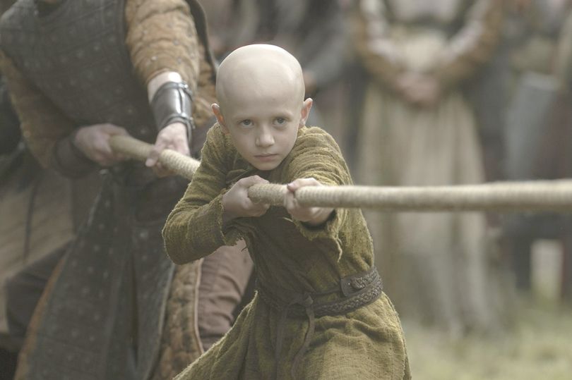 Emmerdale star unrecognisable in new Game of Thrones spin-off