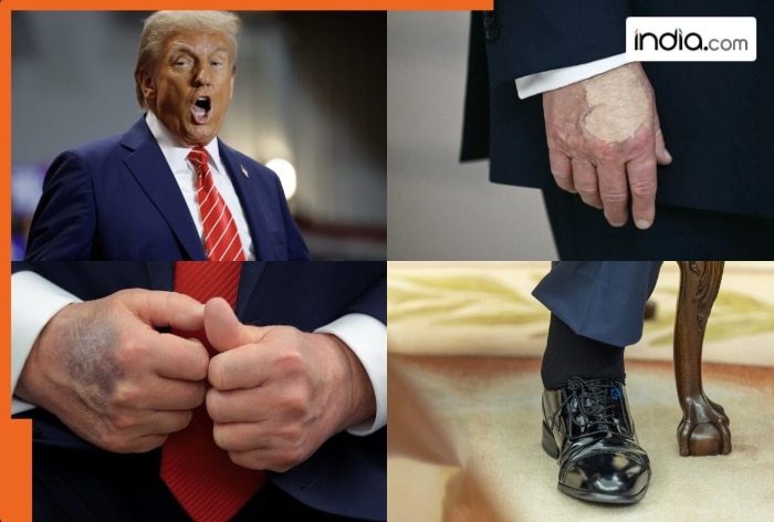 Donald Trump’s health concerns rise alarmingly as symptoms show; not ...