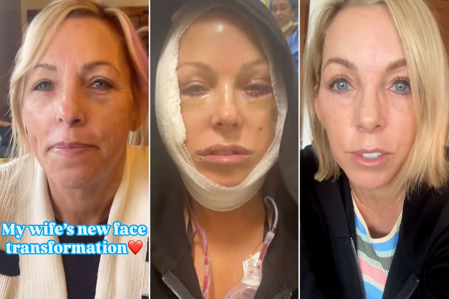 Couple goes viral after husband documents wife's new face ...