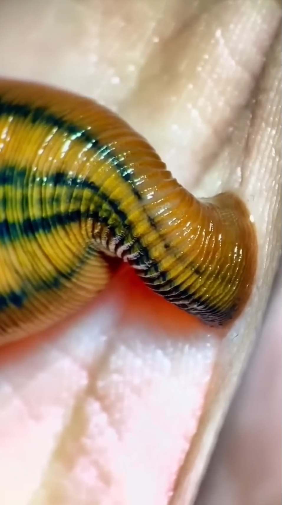 Leech bite under the microscope!