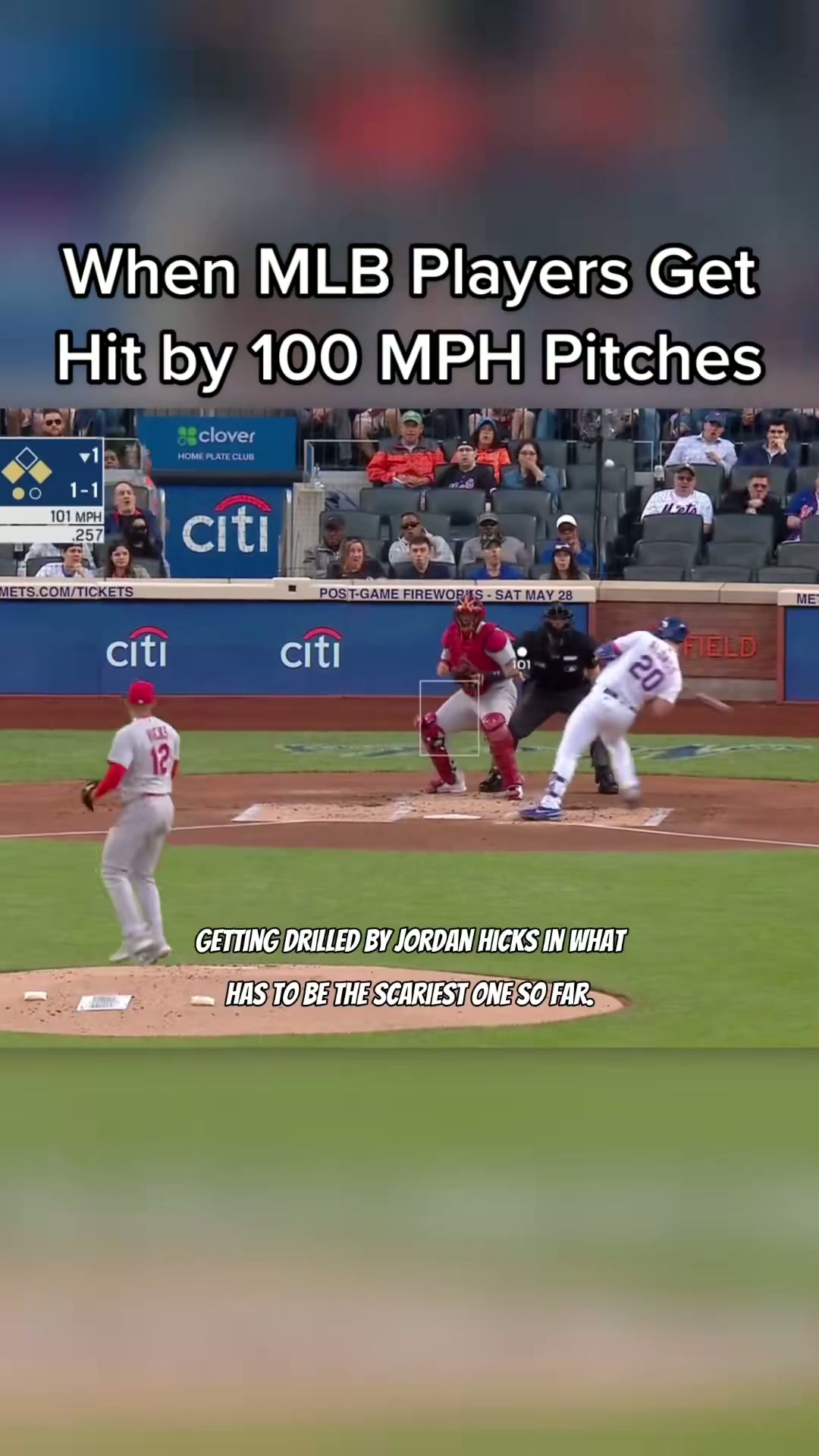 The bruises I’m sure are absolutely mind boggling #MLB #baseball #mlb