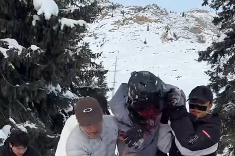Skier bitten in face by snow leopard as horrifying video shows animal ...
