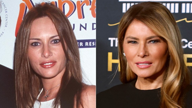 The most jarring plastic surgery transformations in MAGA history