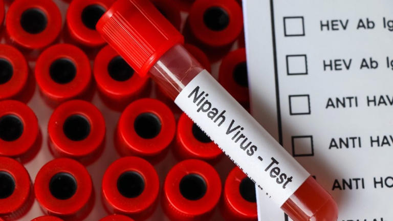 Nipah virus spreads in West Bengal, 100 quarantinedPublished on ...