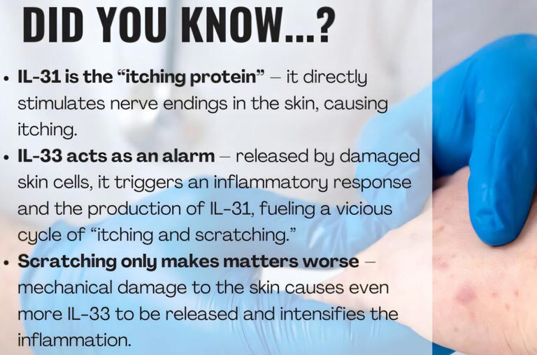Atopic dermatitis under the microscope: Scientists discover the ...