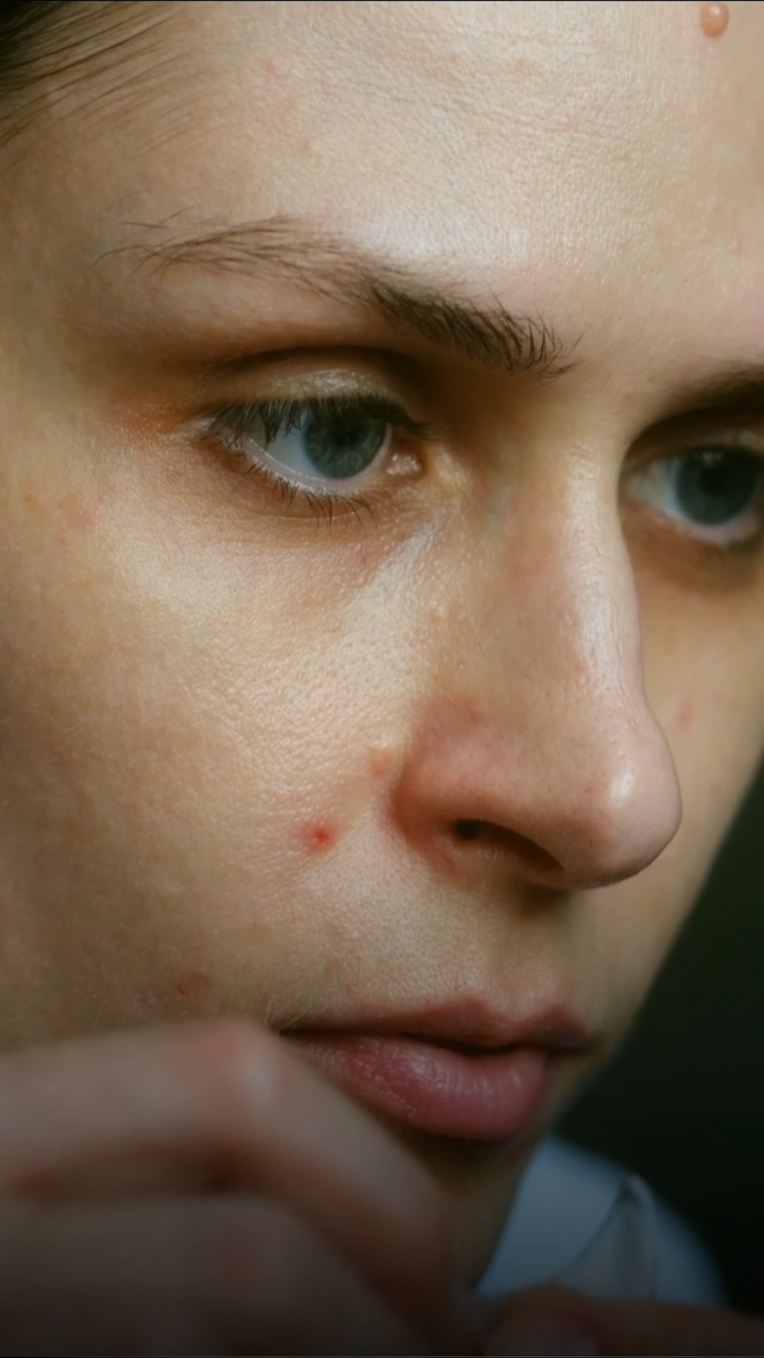 How to reduce the appearance of dark circles under the eyes