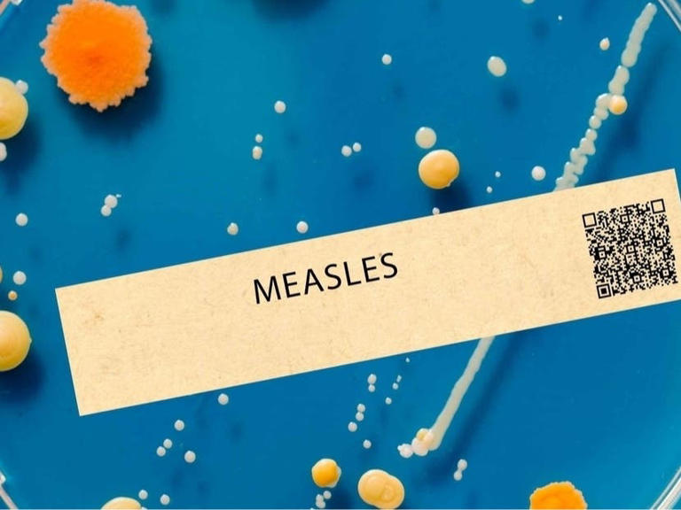 Measles risk in Wayne: See outbreak likelihood map in new report