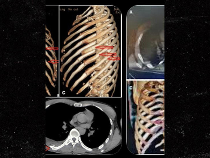 'Pawn Stars' Corey Harrison hospitalized after crash, will miss dad's ...