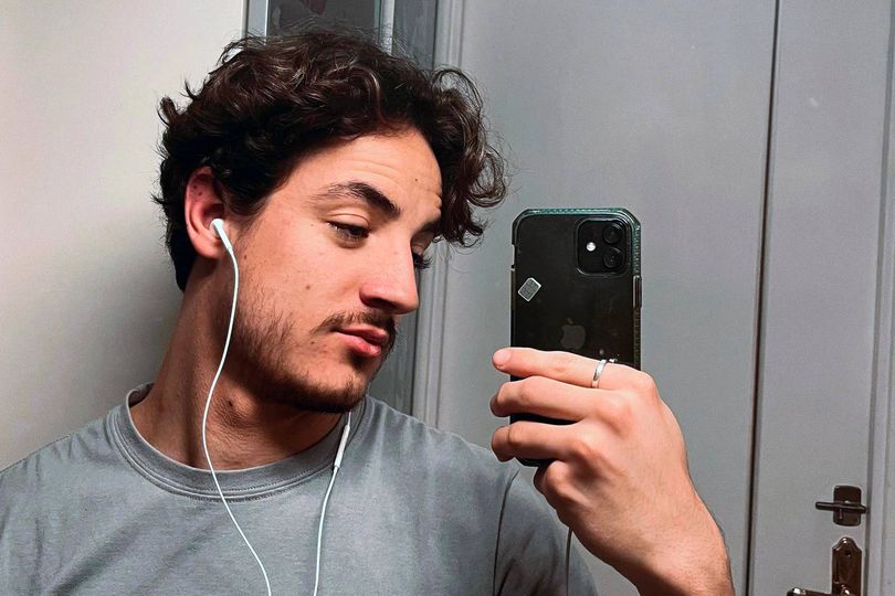 Mi hijo se hizo un trasplante de barba y tres meses después falleció