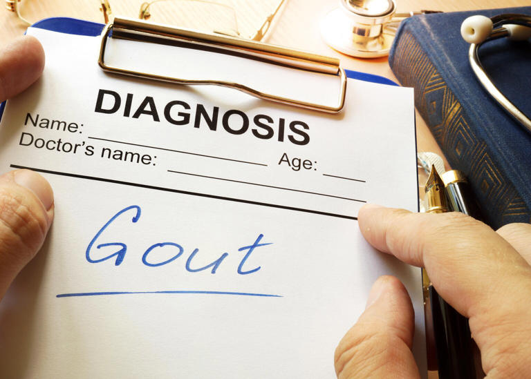 What is gout – and what are the early warning signs to look out for