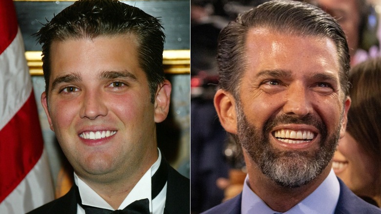 The most jarring plastic surgery transformations in MAGA history
