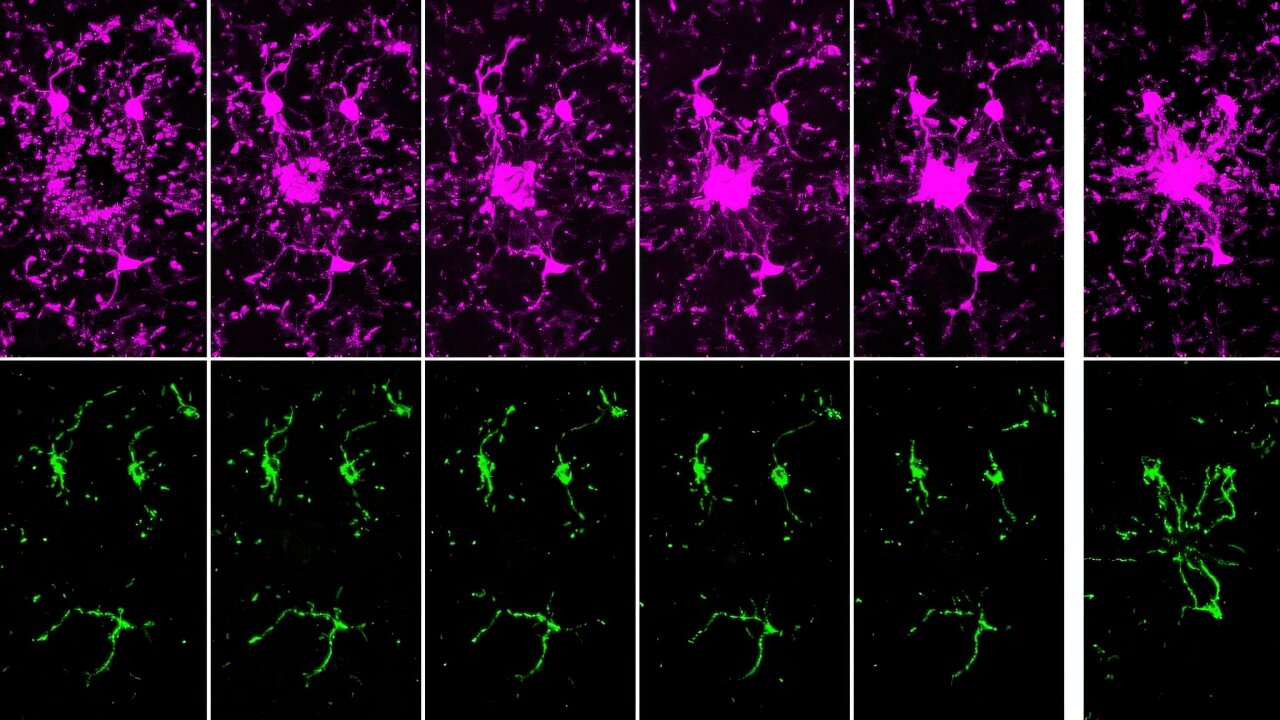 Brain immune cells arrive powered by sugar, then build roads to recruit ...