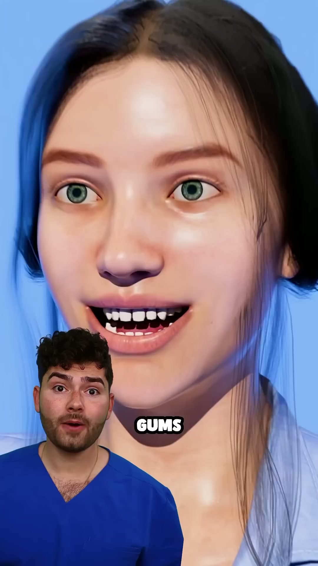 Gum Color Meaning - Dentist Explained