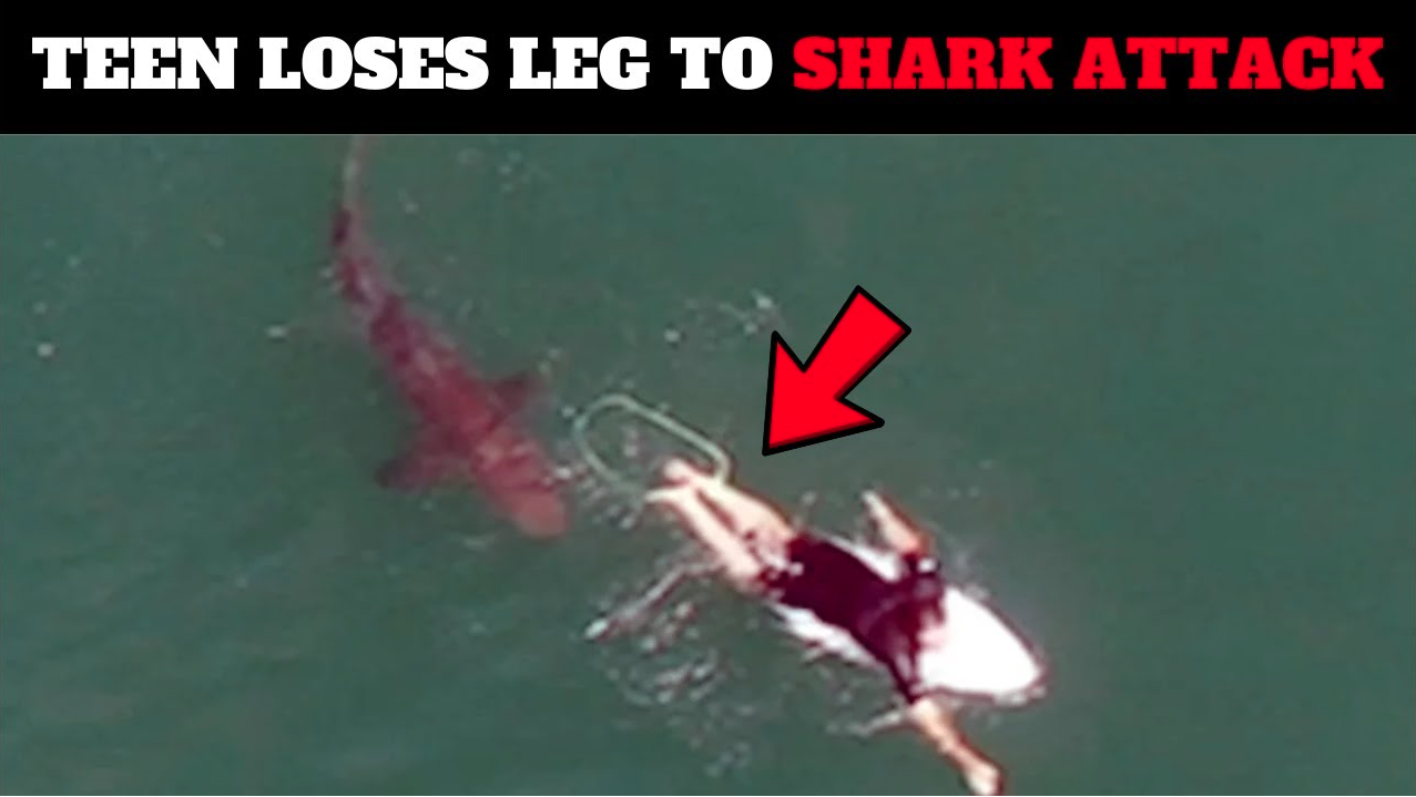 Teenager loses leg to great white shark in horrifying attack caught on ...