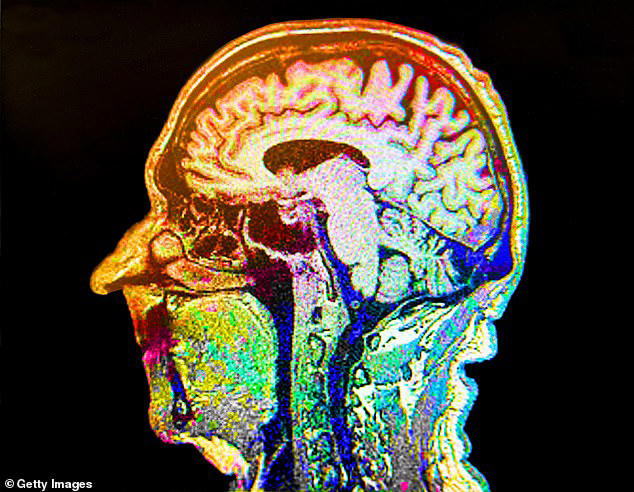 Women face higher dementia risk as they lose grey matter as they go ...