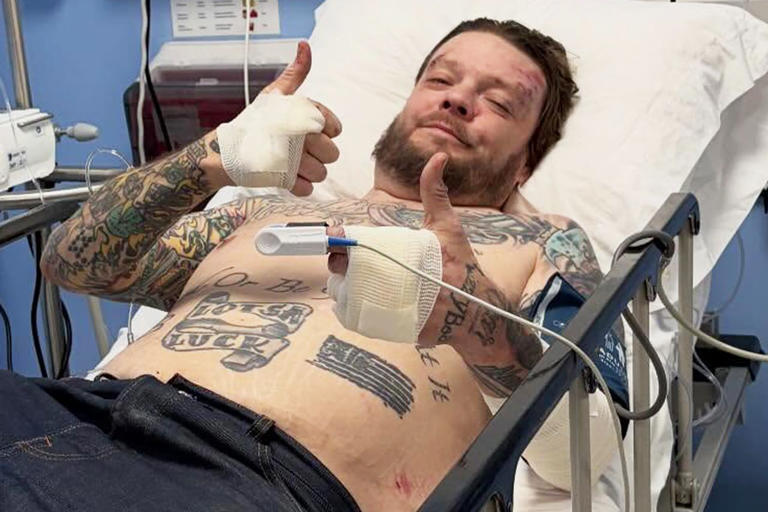 Pawn Stars' Corey Harrison breaks ribs in 11 places in motorcycle crash ...