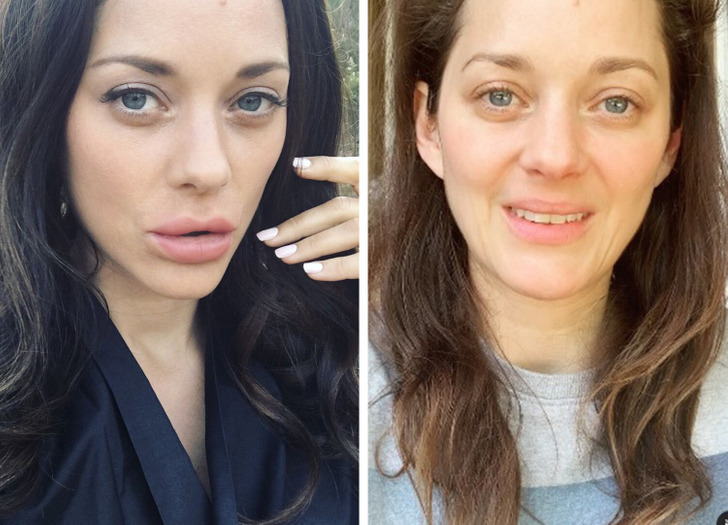 15+ celebrities who bravely showed their real faces
