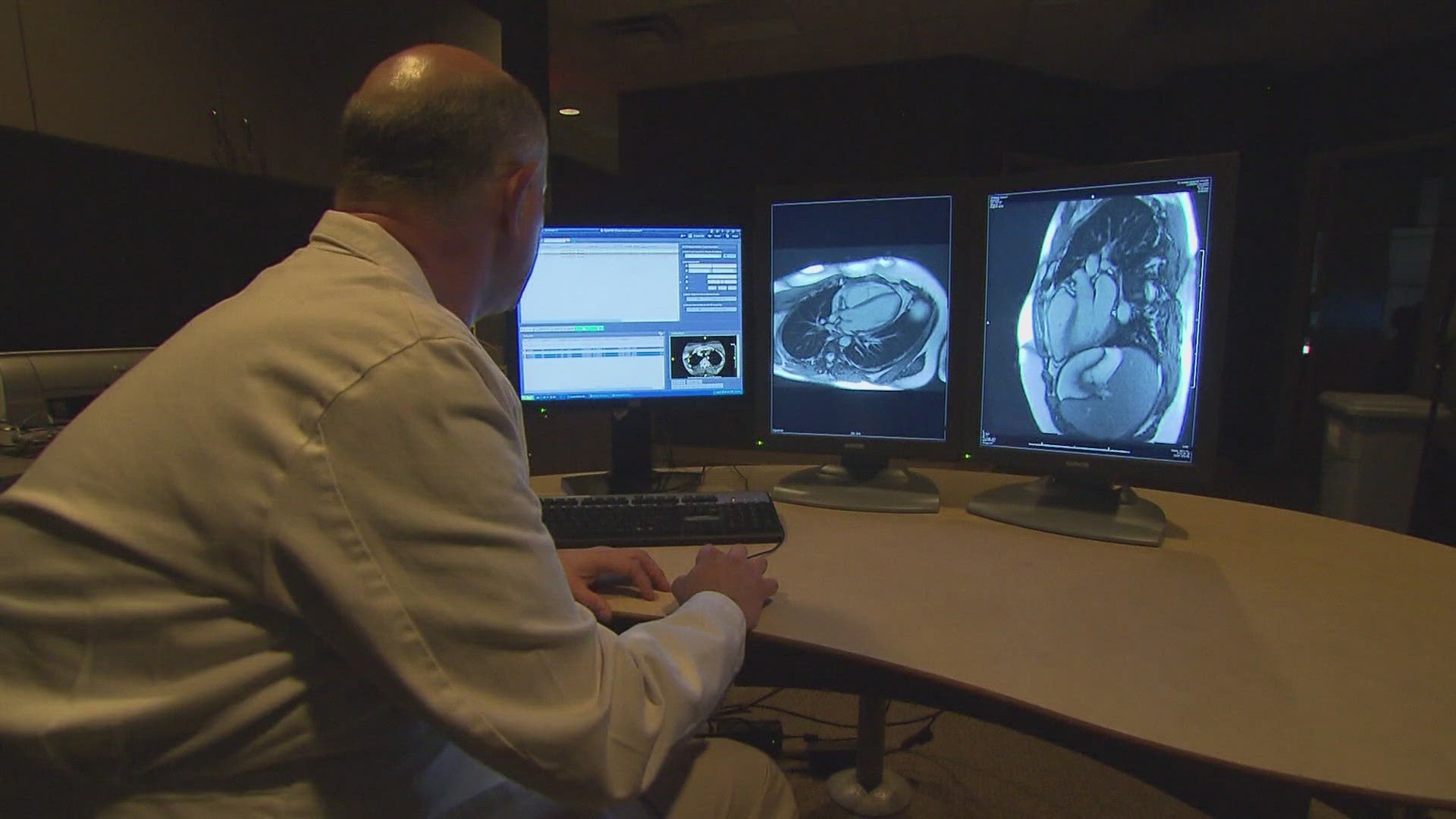 Here is why the cold weather can strain your heart