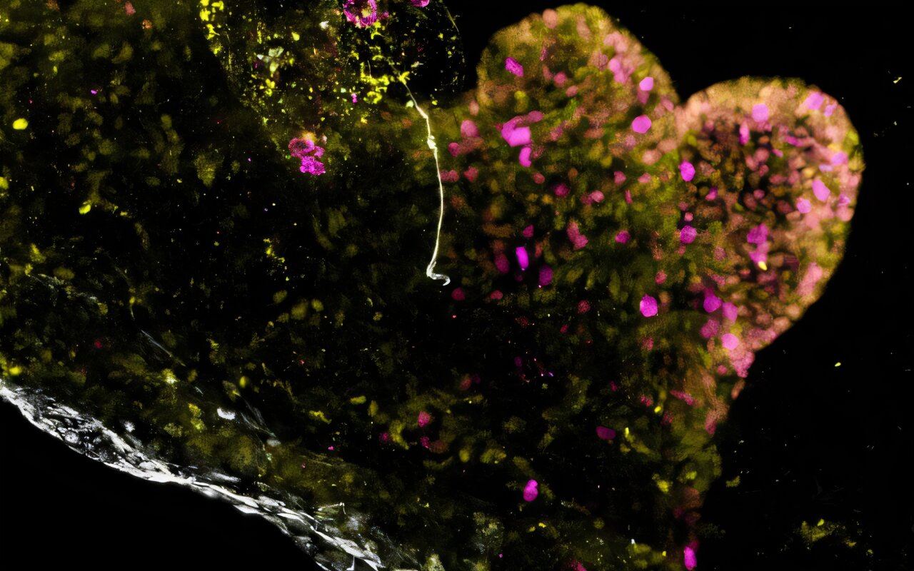 Lab-grown mini-stomachs could boost understanding of rare diseases