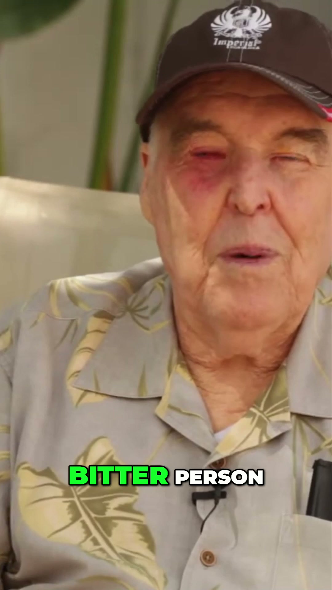 Why media misrepresents pit bulls in attacks