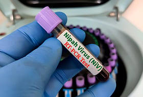 What is Nipah virus? Symptoms and risks explained as India on high alert