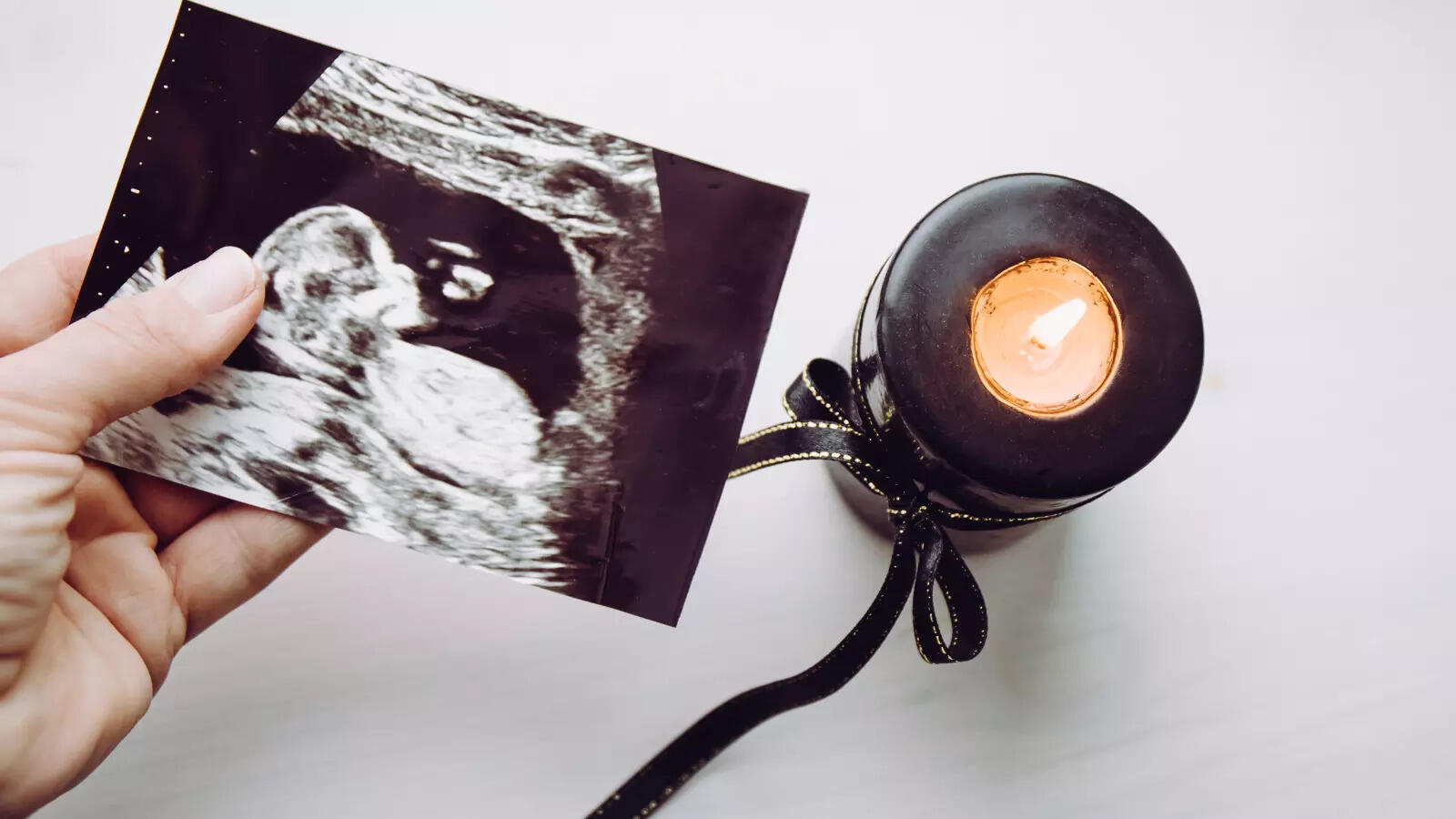 Warning signs, monitoring and evidence-based steps for a safer pregnancy