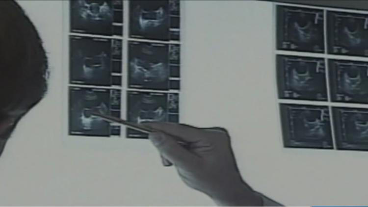 January is cervical cancer awareness month: What you should know ...