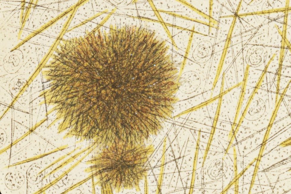 Gout warning: Professor shares key signs that 'small crystals' are ...