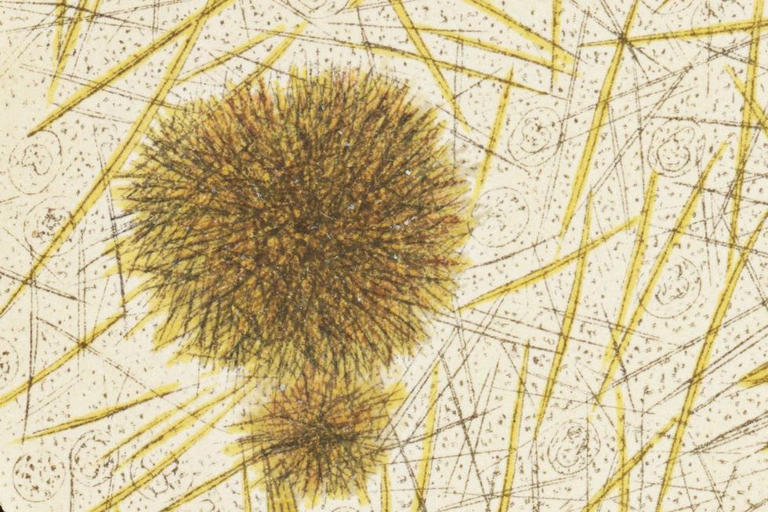 Gout warning: Professor shares key signs that 'small crystals' are ...