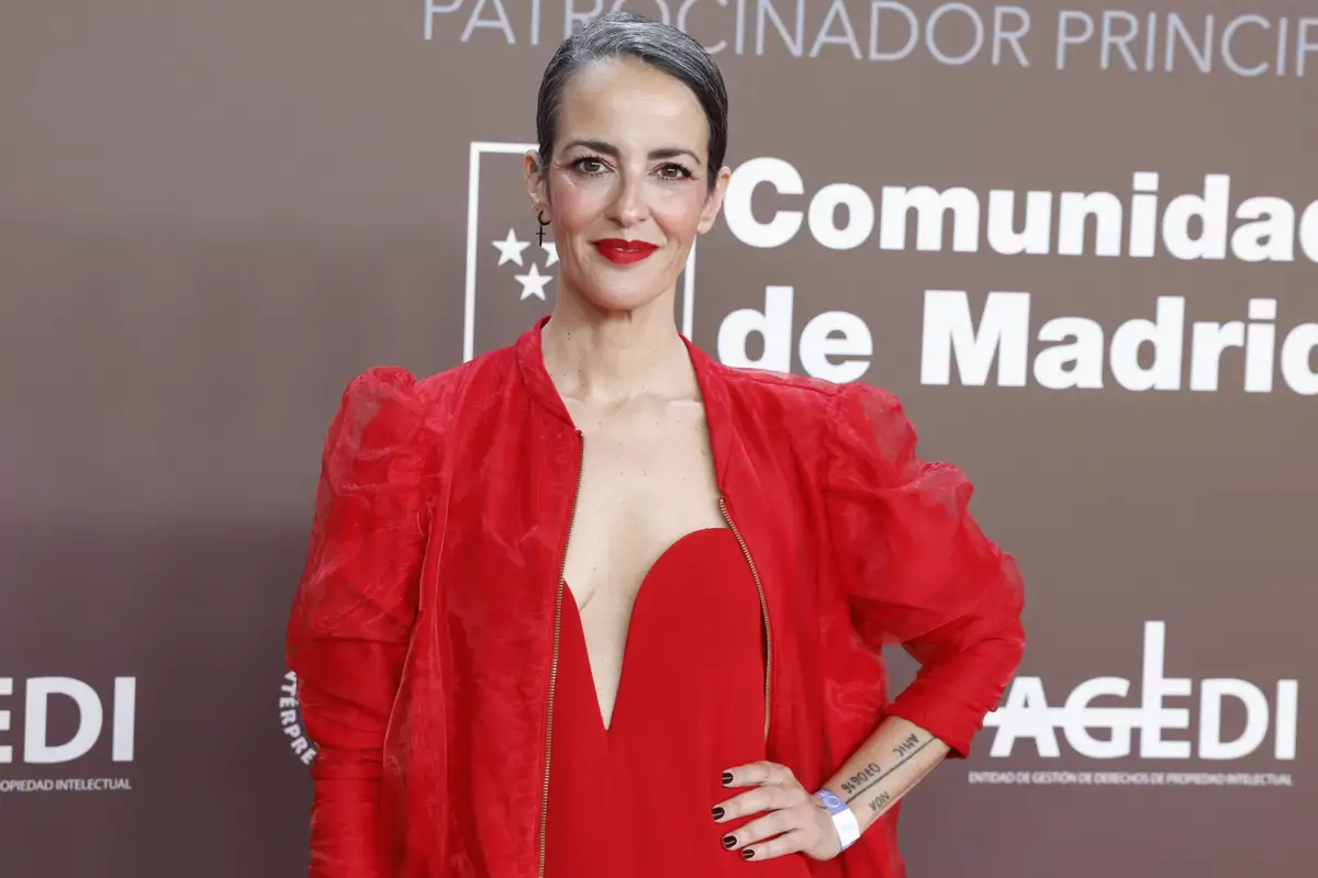 De su polémica estancia en OT a crear su propio sello y tener alopecia ...