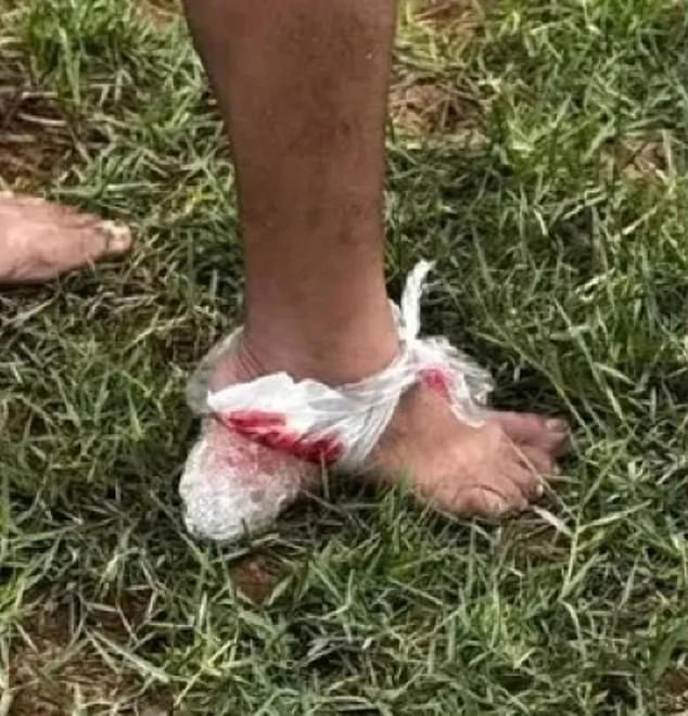 Piranha attack leaves ten people injured and forces Brazil tourist spot ...